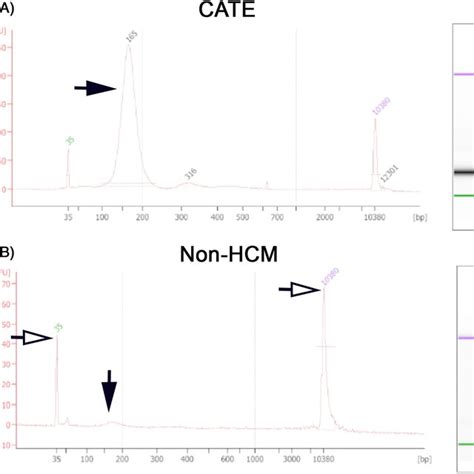 Representative Electrograms Of Plasma Cell‐free Dna Fragment Size And