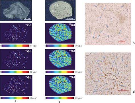 Elemental Distributions Of Gadolinium Isotopes 156 Gd 157 Gd 158 Download Scientific