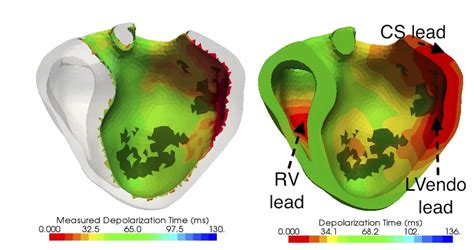 Computational Physiology Epione