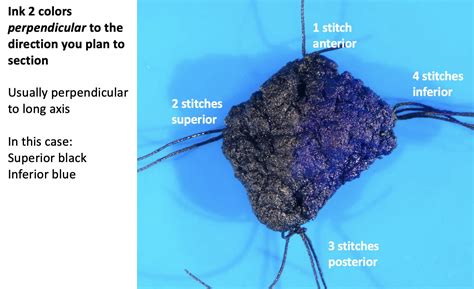 Skin Excision Gross Pathology Manual