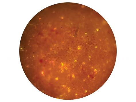 Washing Laundry May Be An Underappreciated Source Of Microplastic