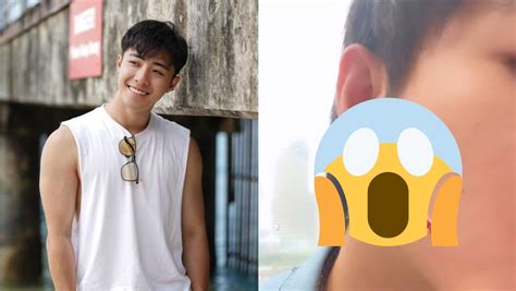 “i Think I Look Quite Badass Now” Zong Zijie Gets 10cm Cut On His Cheek While Filming New