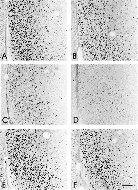 Representative ICC Sections From LS V In Each Of The Six Groups A Download Scientific Diagram
