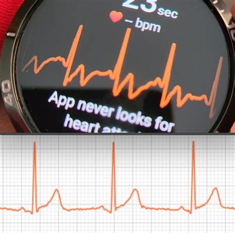 Galaxy Watch Display Ecg Doesnt Match Health App Output Rgalaxywatch