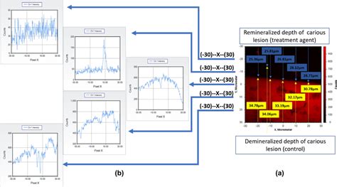 A Representing The Linear Depth Of Lesion In μm As Seen Through Download Scientific Diagram