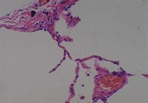 Novus Biologicals Human Lung Tissue Microarray Normal Human Lung