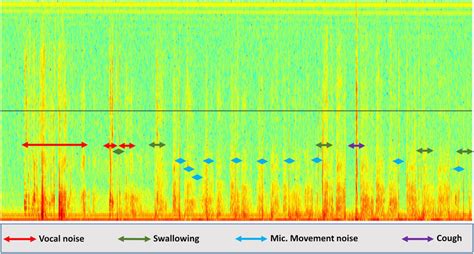 Spectrogram Of A Sample Recording With Vocal Noises Swallowing