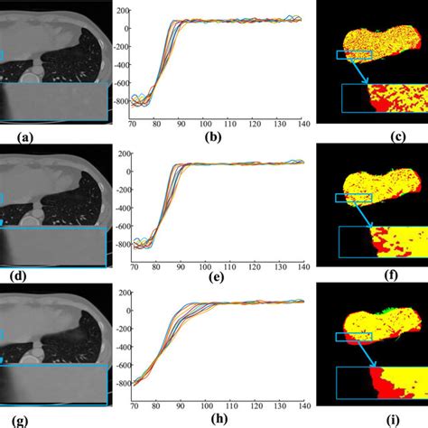 Comparison Of Fourier Filter And The Ad Filter A Original Image B