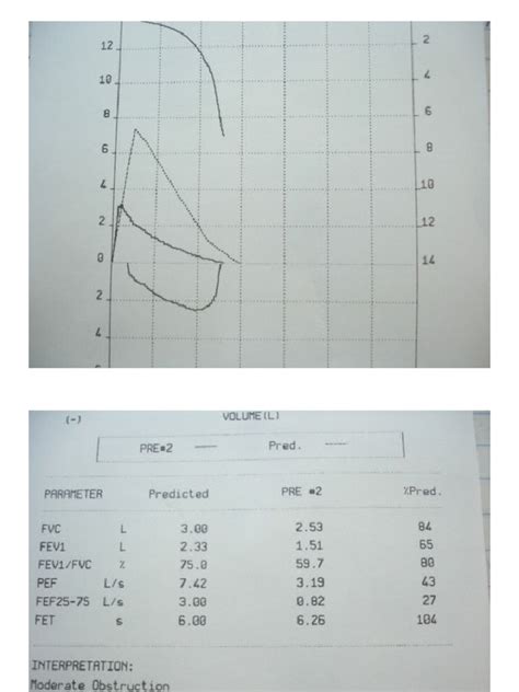 Spirometry Typical Obstrutive Pattern Pdf