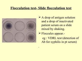Antigen Antibody Reaction Based On Medical Science Ppt