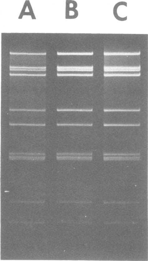 Comparison Of The Electrophoretic Migration Patterns Ofrotaviral