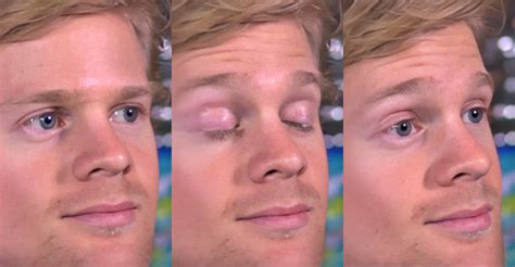 Blinking White Guy Meme Template Insider Memes Viral Meme Generator
