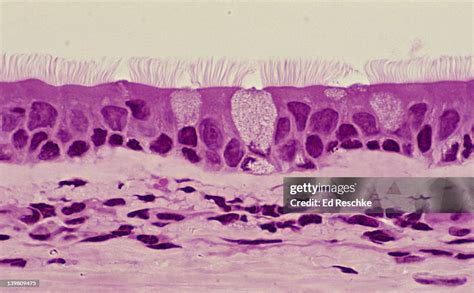 Pseudostratified Ciliated Columnar Epithelium Shows Cilia