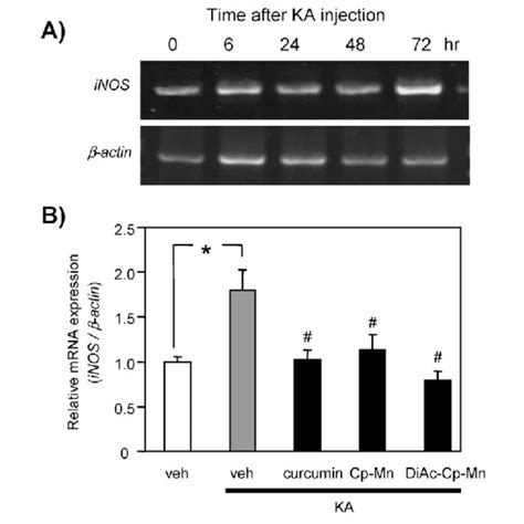 Expression Profile Of Immediate Early Genes Iegs Induced By Ka With Expression Profile Of Immediate Early Genes Iegs Induced By Ka With