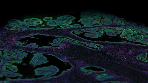 Geomx Digital Spatial Profiler Nanostring