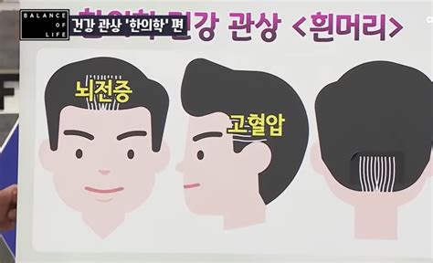 “굳은살과 흰머리 유심히 살펴보세요” 위험한 뇌졸중 전조 증상을 미리 알아내는 방법 뉴스충전