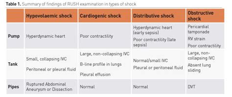 Pocus And Shock