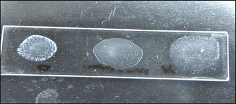 Rapid Bacterial Test Kit Salmonella Agglutinating Latex 30