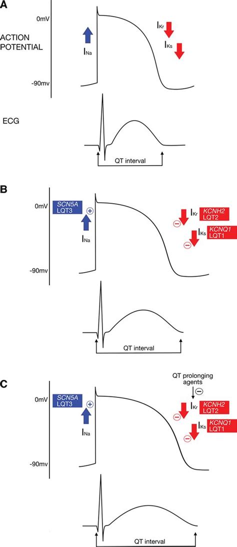 Long Qt Syndrome Circulation