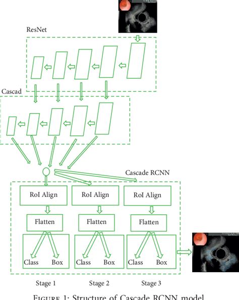 Figure 1 From Utilization Of Ultrasonic Image Characteristics Combined With Endoscopic Detection
