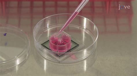 Differentiating Human Induced Pluripotent Stem Cells Into Neurons On