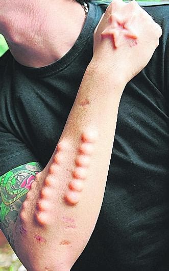 8 Most Crazy Body Modifications