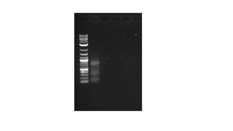 140 Questions With Answers In Nested Pcr Scientific Method