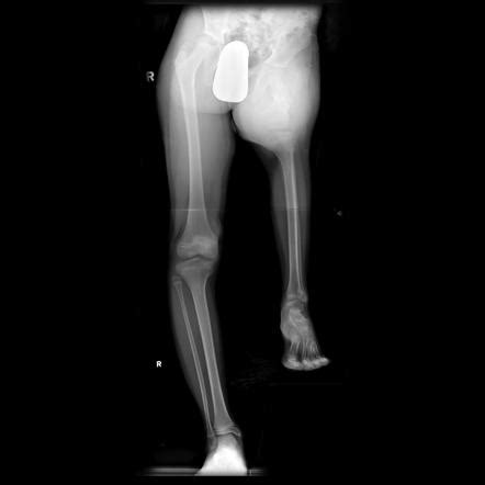 Image Radiopaedia Org