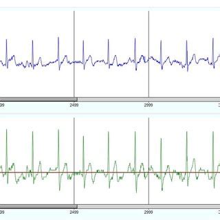 Noise Influence On The Algorithm Recognition Step Download Scientific Diagram