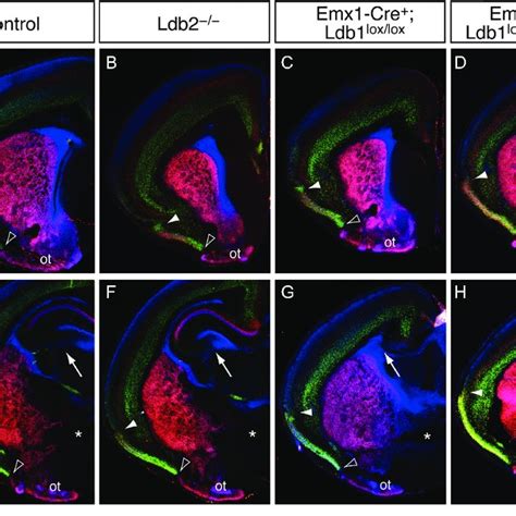 Lack Of Hippocampus And Expansion Of Piriform Cortex Into Lateral Download Scientific Diagram