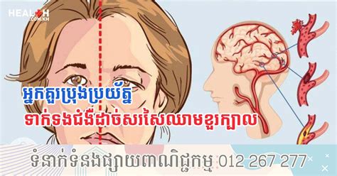 រោគសញ្ញា ព្រមាន ដែល អ្នក គួរ ប្រុងប្រយ័ត្ន ទាក់ទង ជំងឺ ដាច់ សរសៃឈាម ខួរក្បាល