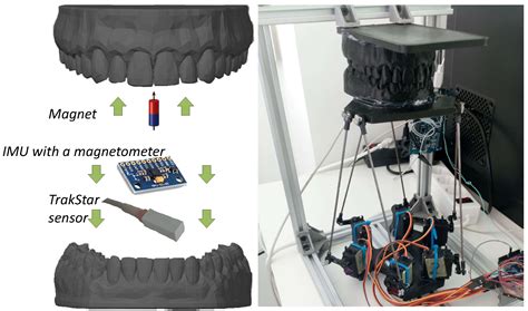 Accelerometry Enhanced Magnetic Sensor For Intra Oral Continuous Jaw Motion Tracking