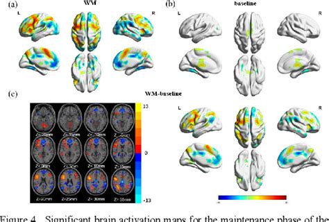 Figure 1 From Hemispheric Lateralization And Top Down Regulation Of The