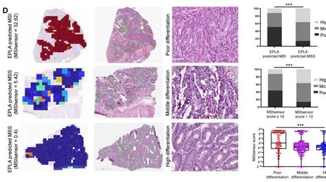 Mri影像 病理多模态组学标书设计 预实验：mri放射组学模型预测癌症化疗后病理 哔哩哔哩
