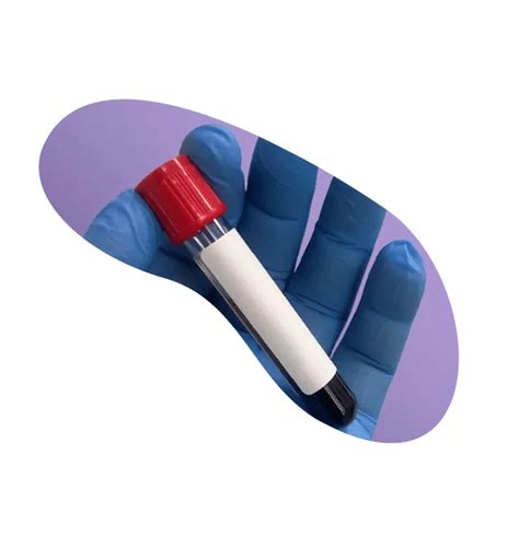 Tumor Surgery