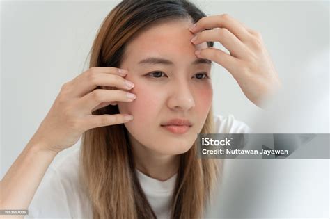 젊은 여성 아시아 얼굴이 걱정됩니다 피부과와 화장품의 스테로이드에 알레르기가 있습니다 민감한 피부 햇볕에 탄 붉은 얼굴 여드름 화학 물질에 알레르기 얼굴에 발진 피부
