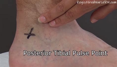 Pulse Points Nursing Assessment