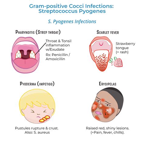 Immunology Microbiology Glossary Streptococcus Pyogenes Ditki