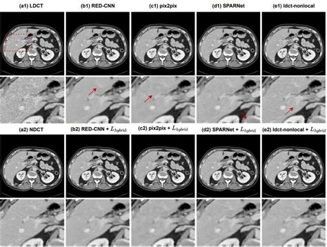 self‐adaption and texture generation a hybrid loss function for low