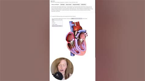 Next Gen Nclex Case Atrial Fibrillation Ekg Pt 1 Youtube