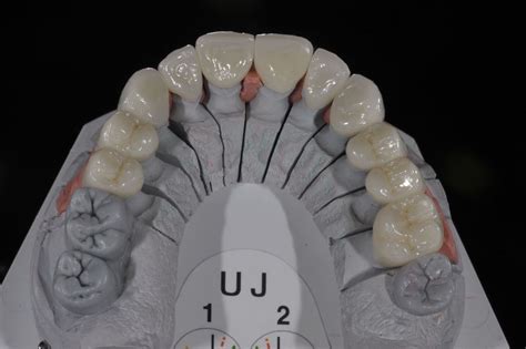 All Ceramic Art Dental Lab
