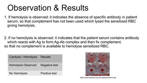 Complement Fixation Testppt Blood Disorders Diseases And Conditions