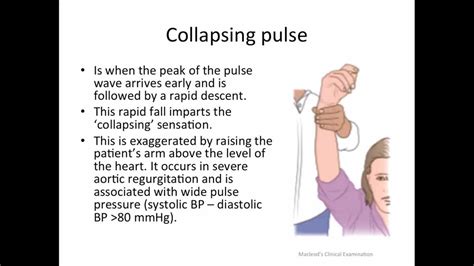 The Science Behind Dr Arthur Coca S Revolutionary Pulse Test Revealed