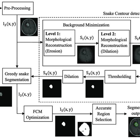 Block Diagram Of Proposed Brain Tumor Segmentation Method Download