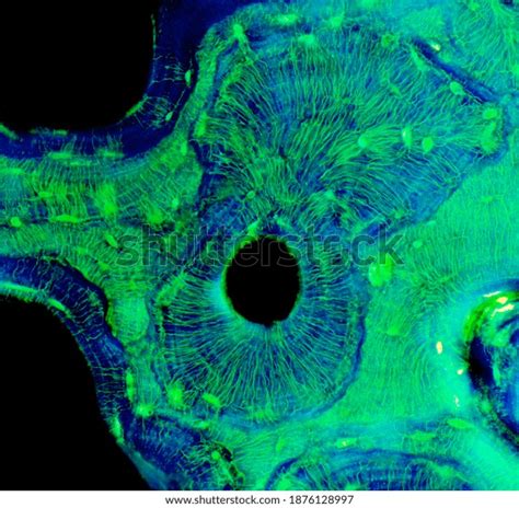 Compact Bone Under Light Micrograph Stock Illustration 1876128997 Shutterstock