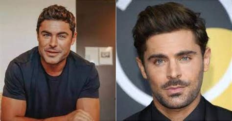 ¡finalmente Zac Efron Revela Qué Le Pasó En Su Rostro Tras Especulaciones De Haber Abusado Del