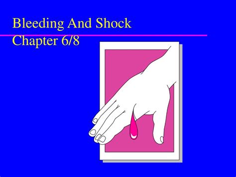 Ppt Bleeding And Shock Chapter 6 8 Powerpoint Presentation Free Download Id 725885