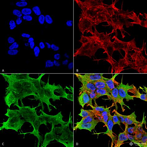Anti Glua1 Glur1 Antibody 56547 Leinco Technologies
