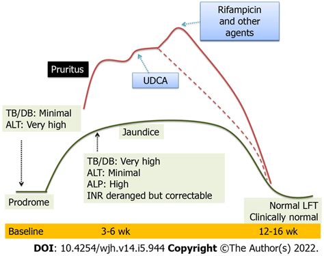 Natural History Of Prolonged Cholestasis In Acute Viral Hepatitis Lft