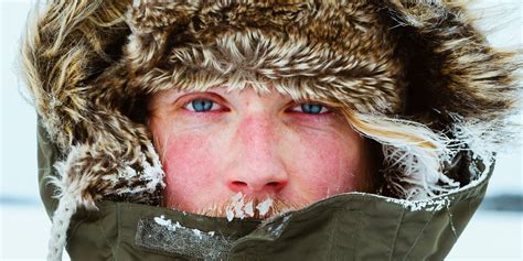 How To Prevent And Treat Windburn Winters Overlooked Skin Condition